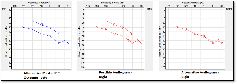Implications of an ABG for Fitting Software